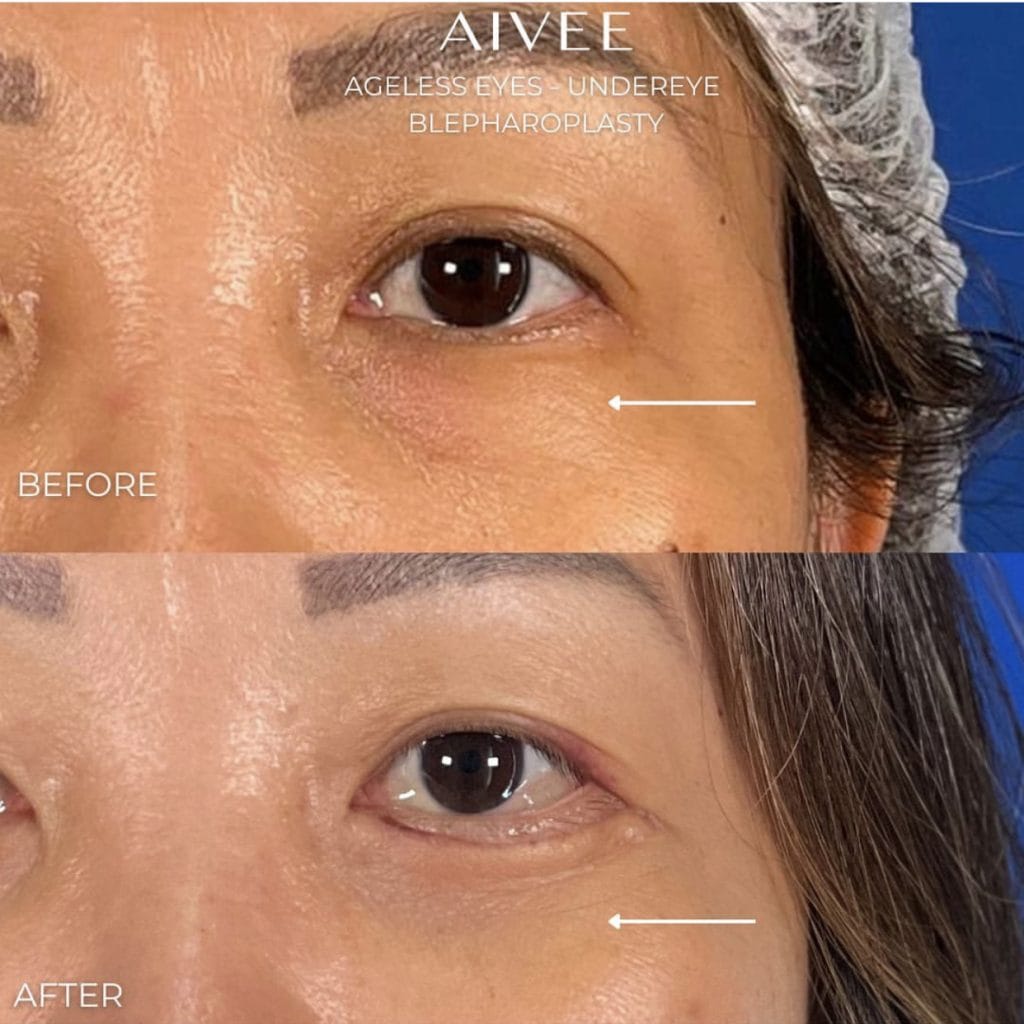 The Aivee Group | The Aivee Group