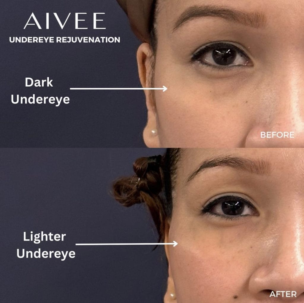Our Results | The Aivee Clinic