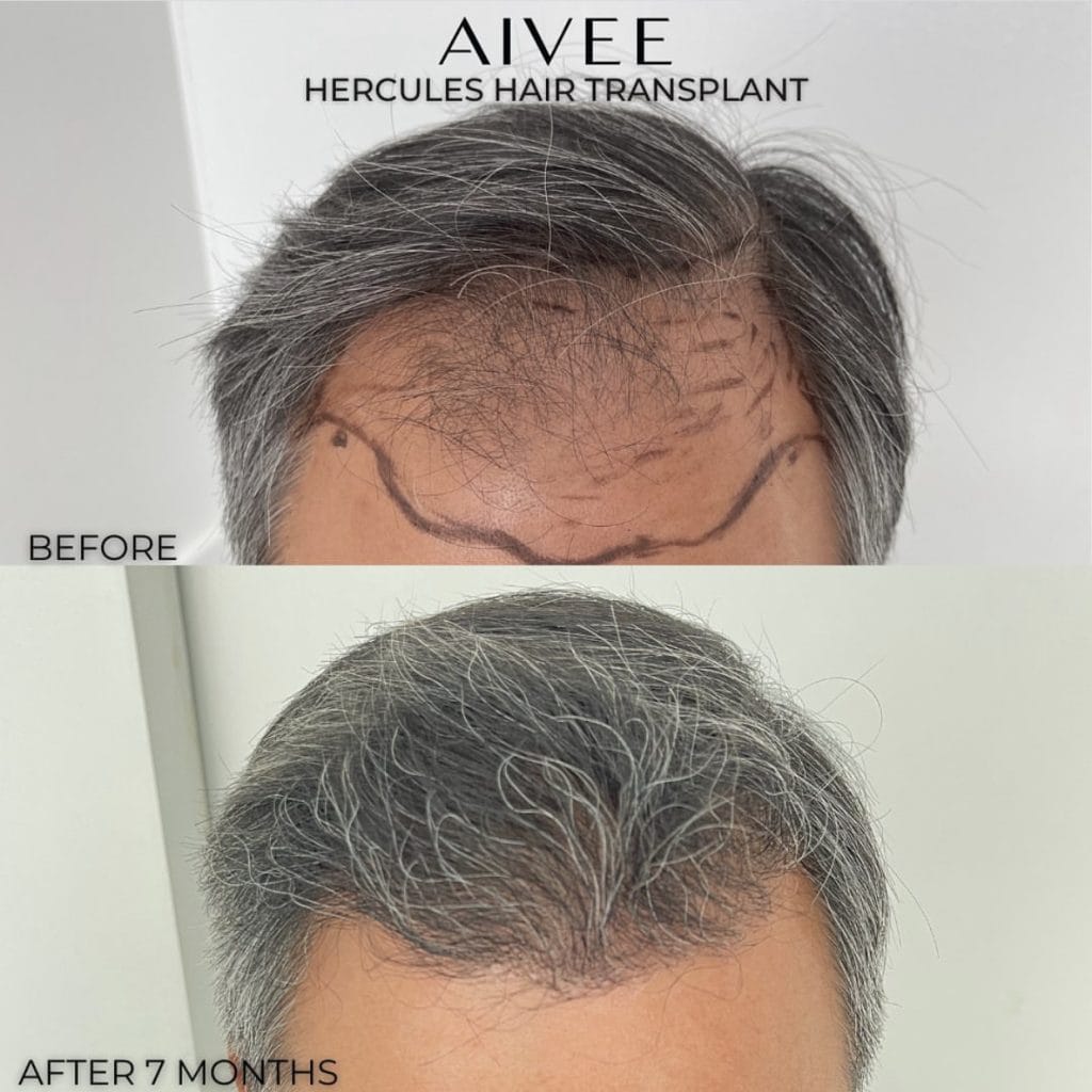 The Aivee Group | The Aivee Clinic