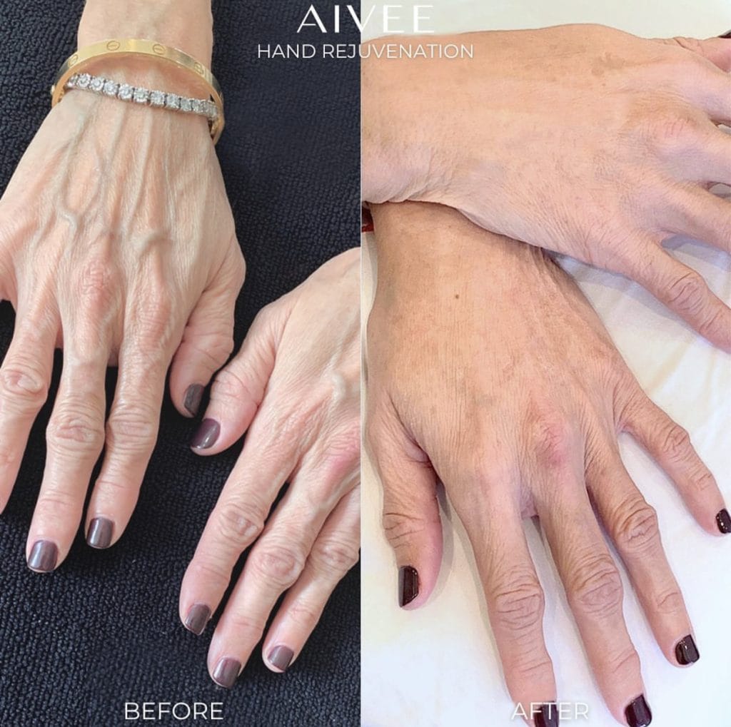 The Aivee Group | The Aivee Group