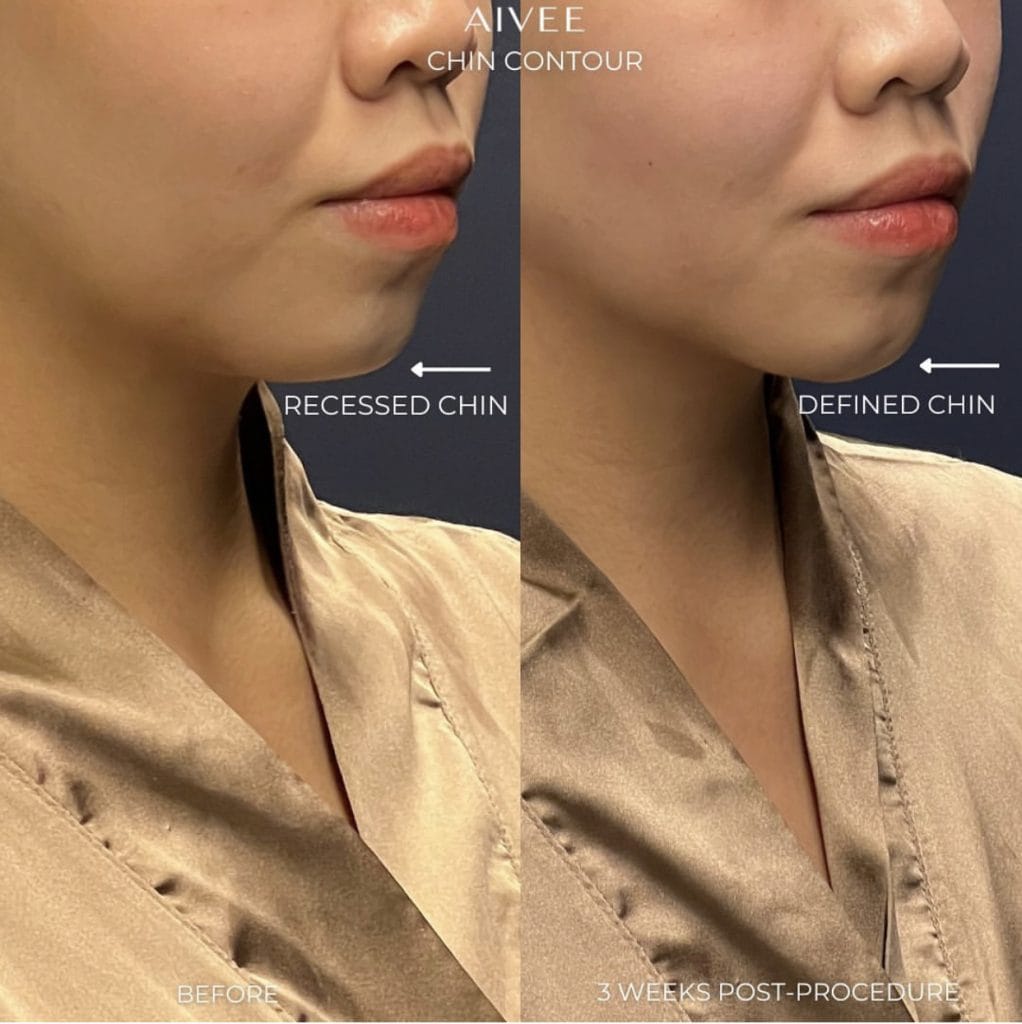 The Aivee Group | The Aivee Clinic