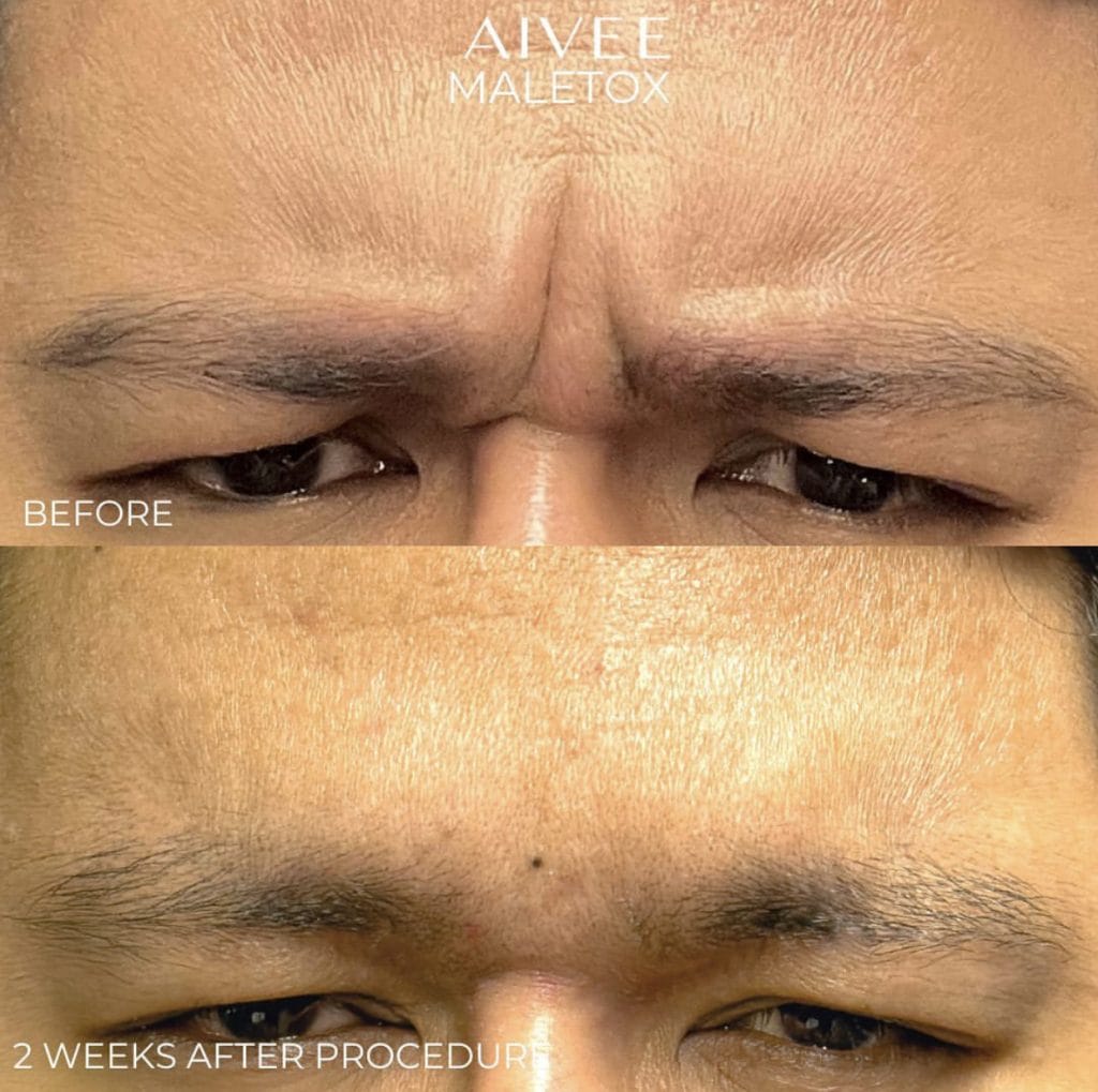 Our Results | The Aivee Clinic