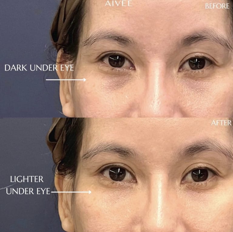 The Aivee Group | The Aivee Clinic