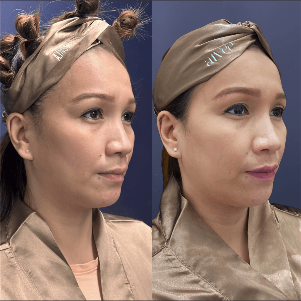 Our Results | The Aivee Group